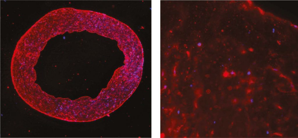 37. Serum-Free Manufacturing of Mesenchymal Stem Cell Tissue Rings ...